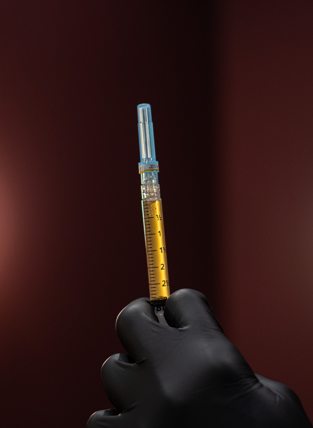 Platelet-Rich-Plasma (PRP) overview • Elinea